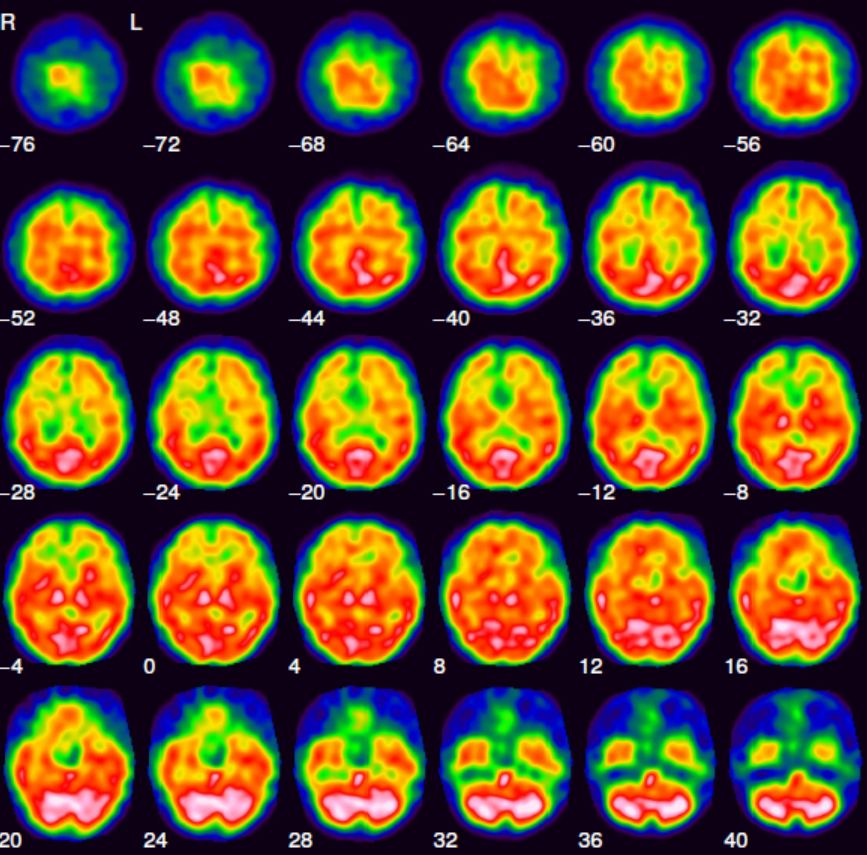 Technetium – Ein künstliches Element macht Karriere im Krankenhaus ...